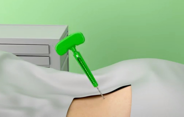 OSTEOBELL "T" - Ac pentru Biopsia Maduvei Osoase