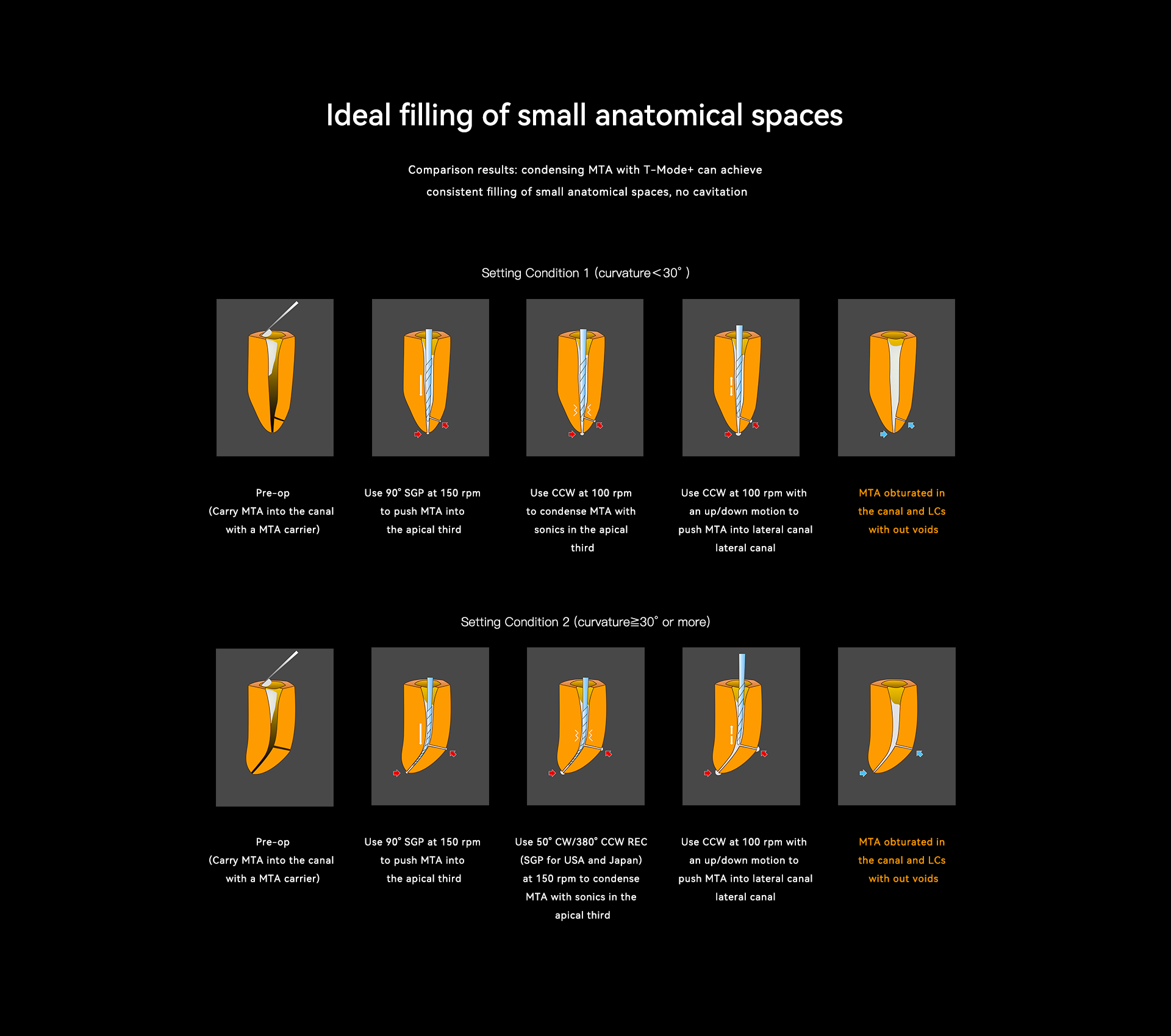 Endomotor 812MT cu apex locator integrat si functie de vibratie Woodpecker