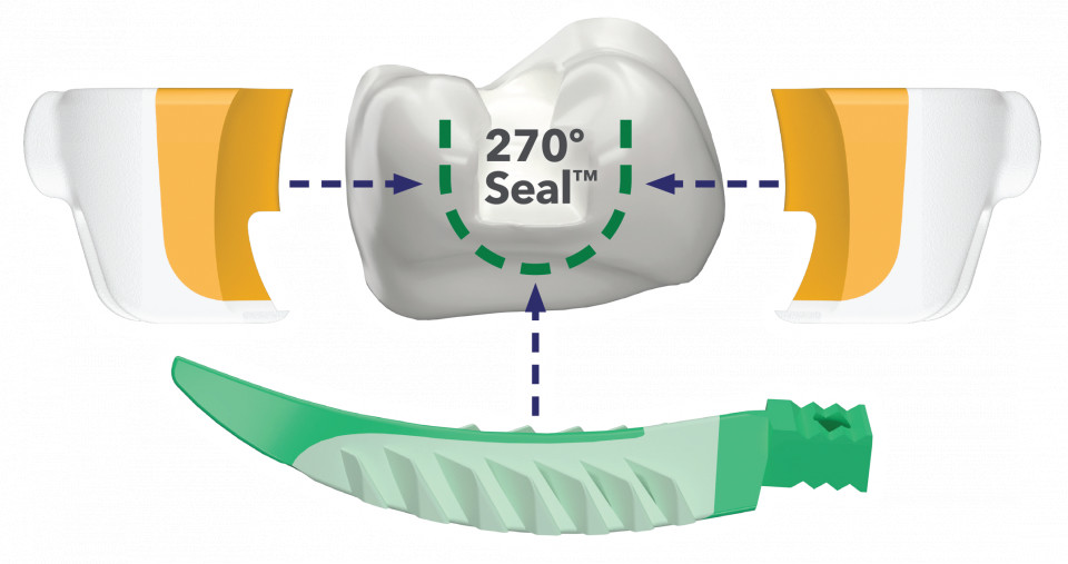 Matrice sectionale set Strata-G Garrison