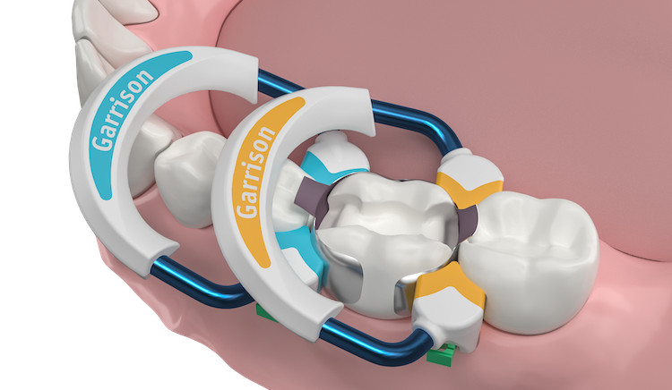Matrice sectionale set Strata-G Garrison